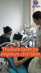 1927nm Thulium Laser For Anti-aging Skin And Assisting hair Regrowth - Beauty Machine ...