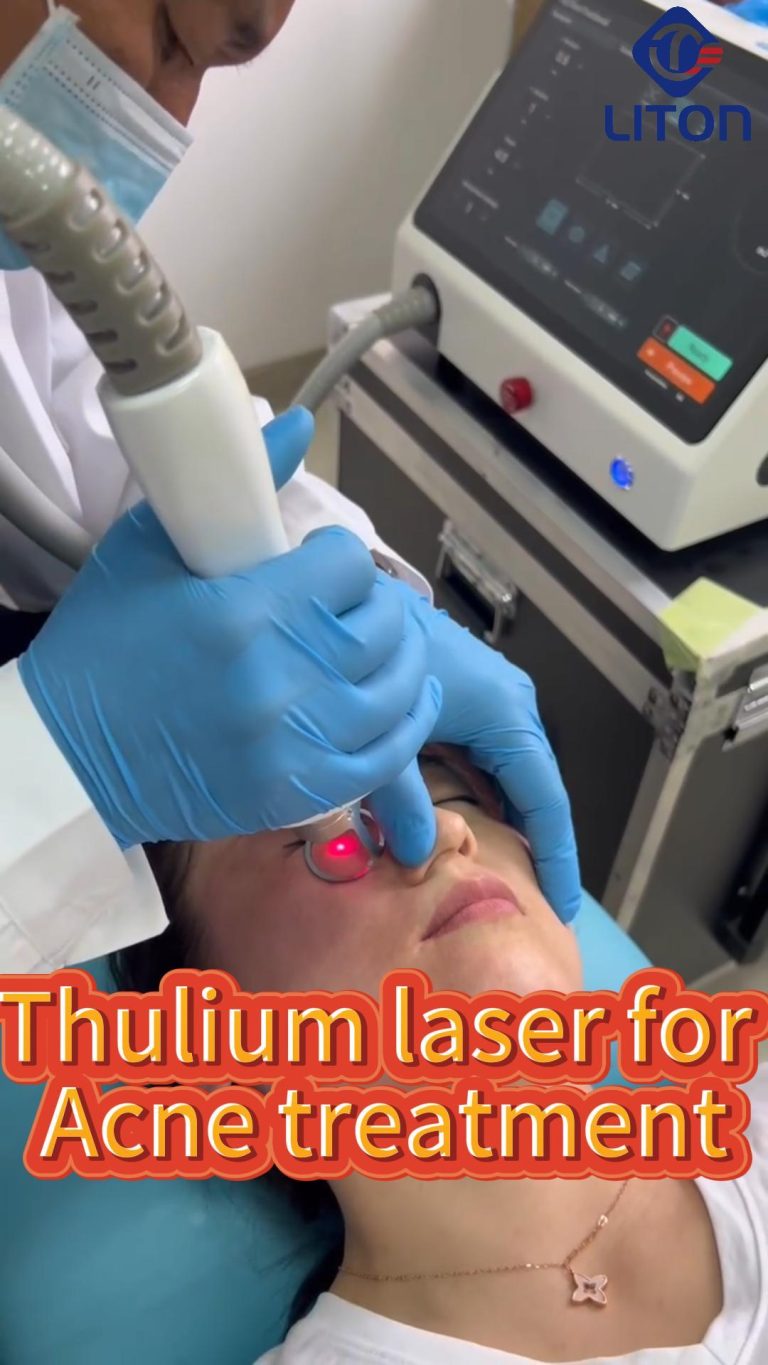 1927nm Thulium Laser For Anti-aging Skin And Assisting hair Regrowth - Beauty Machine ...