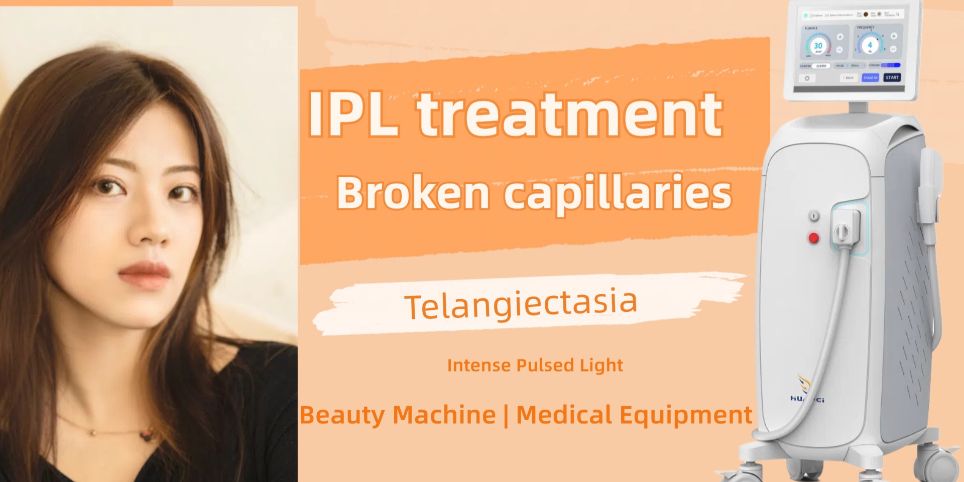 IPL treatment for broken capillaries, how to set the treatment parameters for better results?