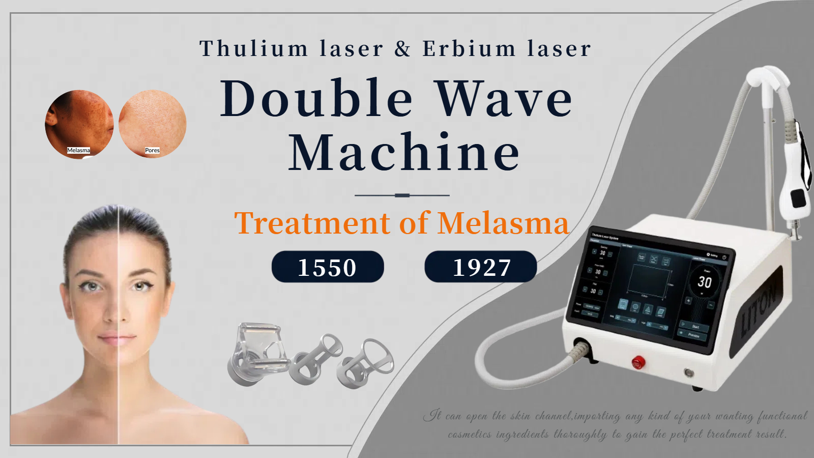 1550 Erbium Laser และ 1927 Thulium Laser รักษาฝ้า